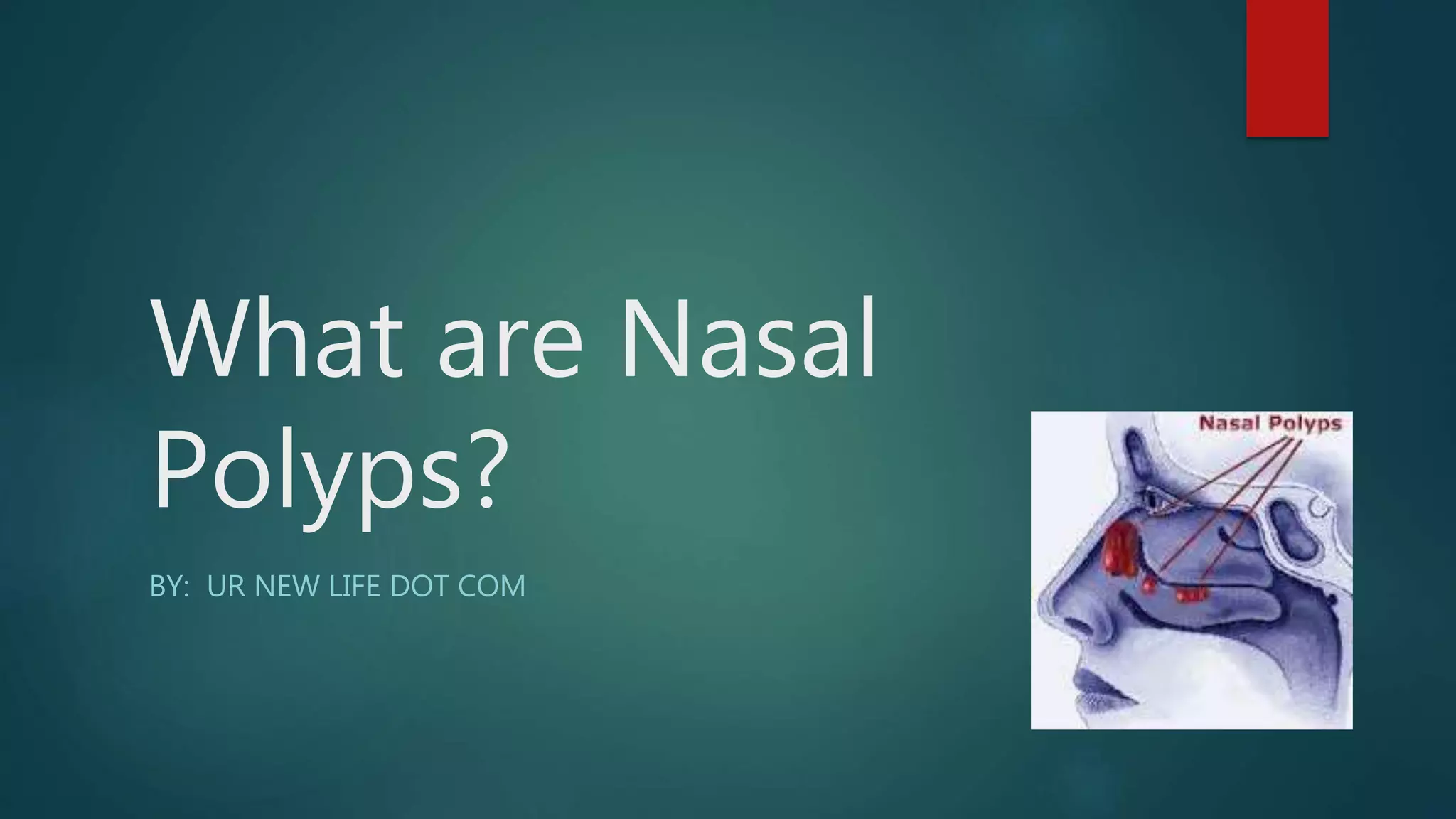 What are nasal polyps | PPTX