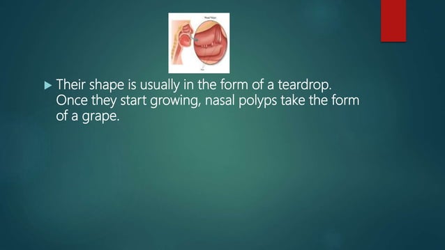 What are nasal polyps | PPT