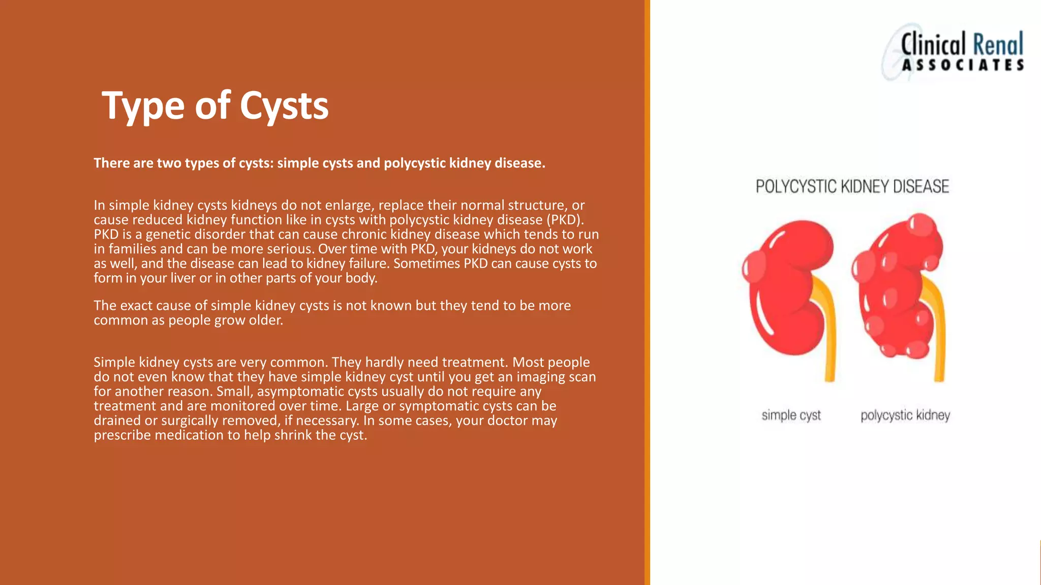 What are simple kidney cysts.pptx