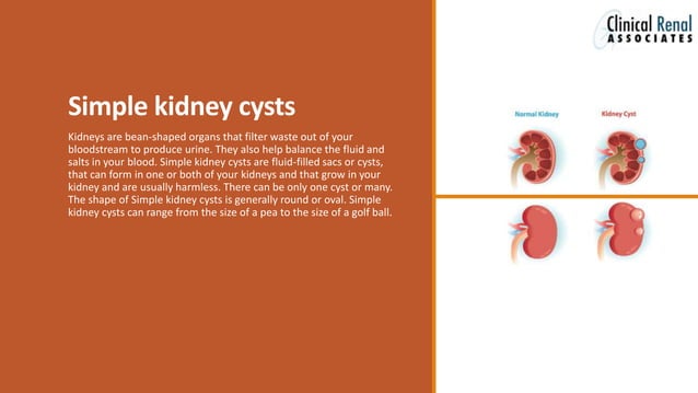 What are simple kidney cysts.pptx