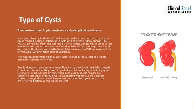 What are simple kidney cysts.pptx