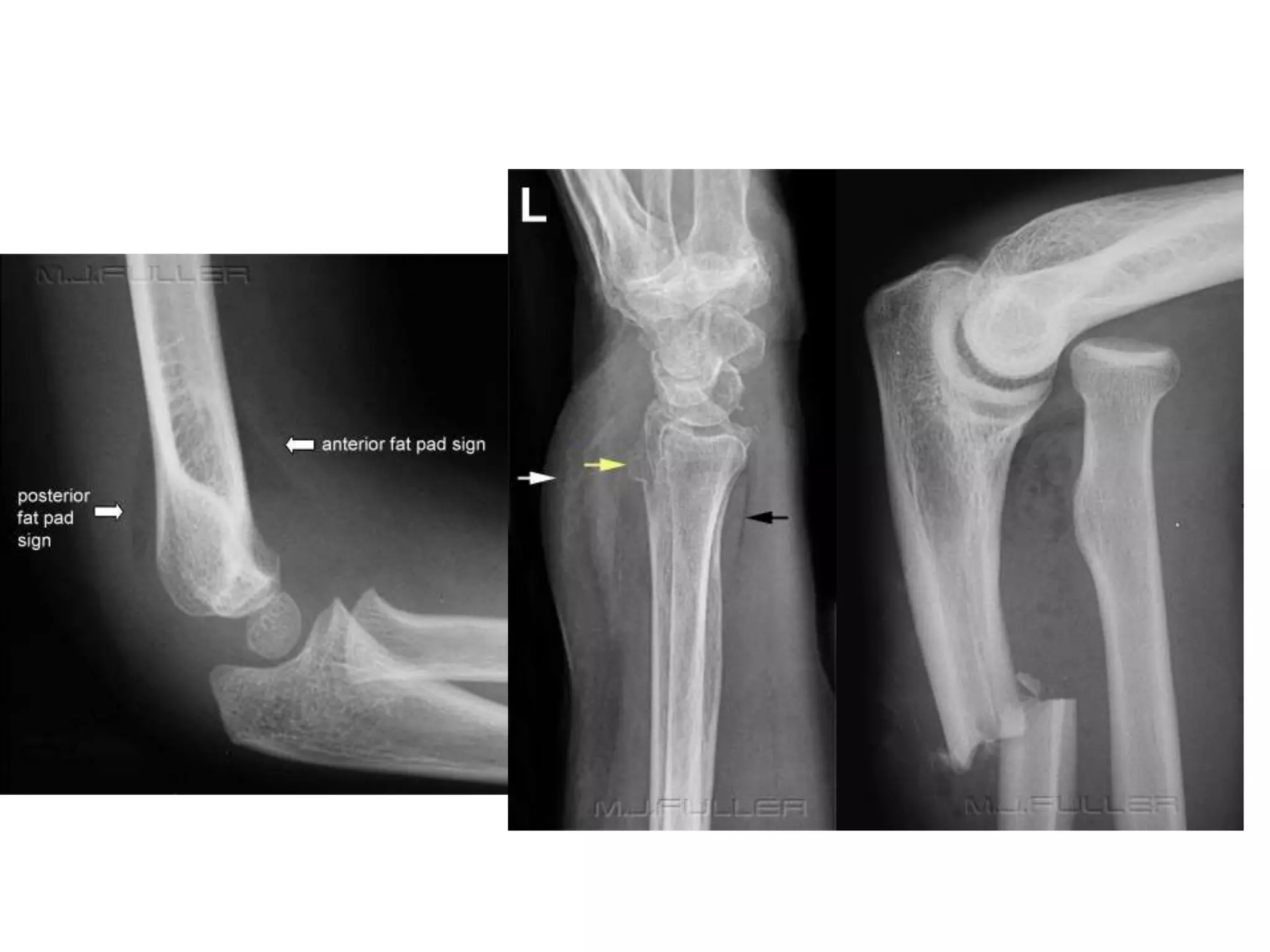 soft tissue radiography | PPTX