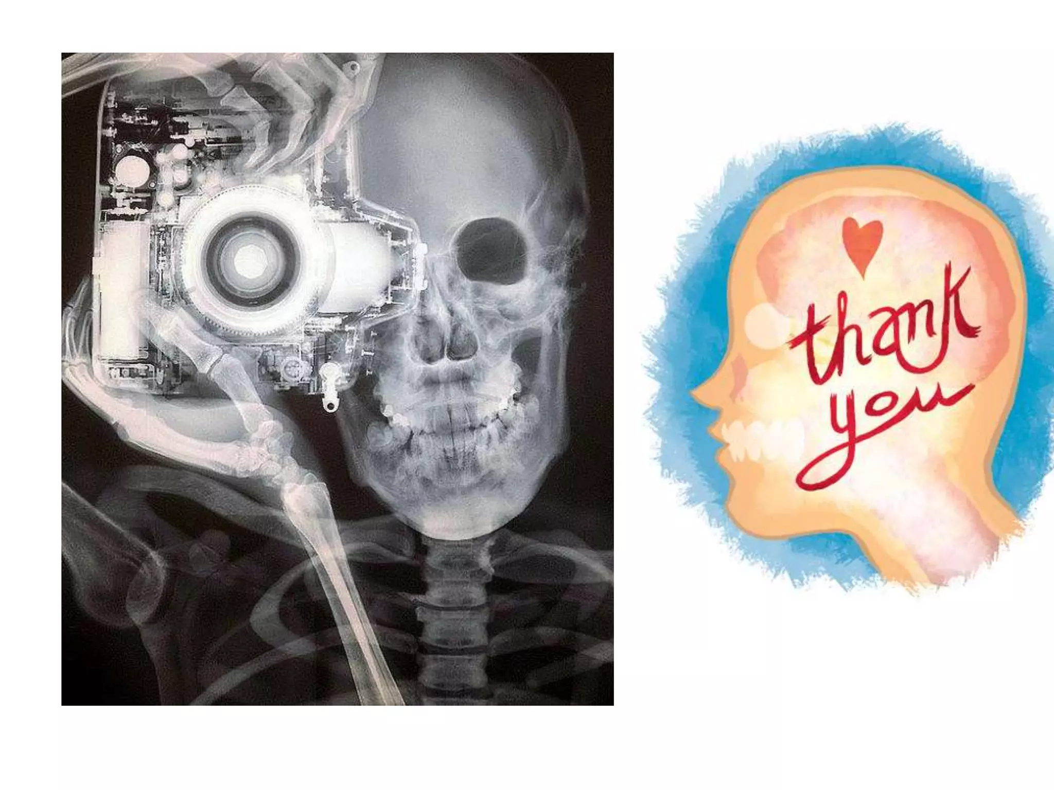 soft tissue radiography | PPTX