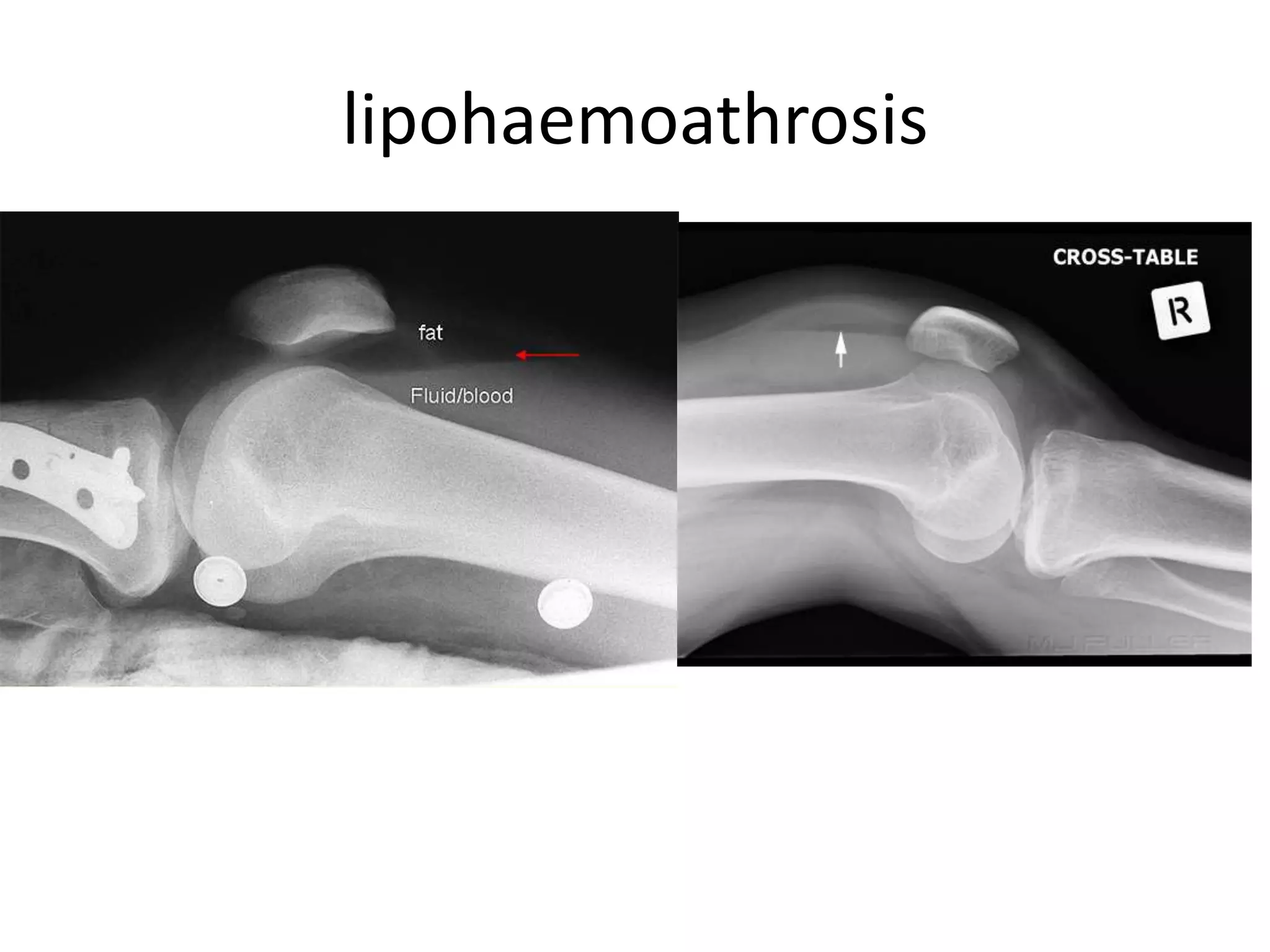 soft tissue radiography | PPTX