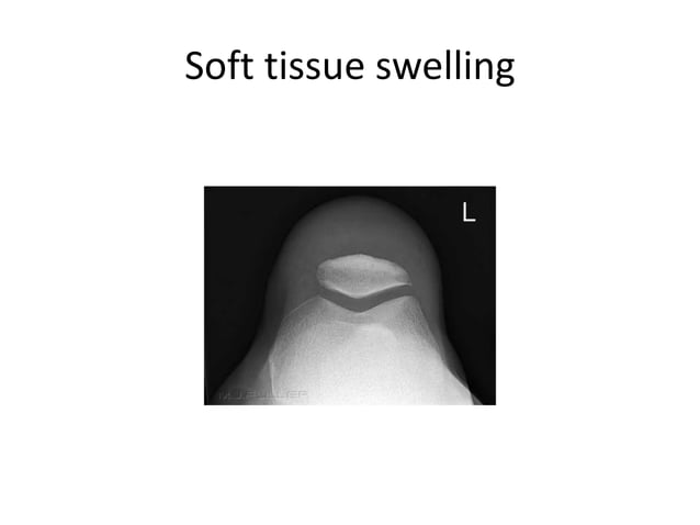 soft tissue radiography | PPTX