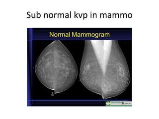 soft tissue radiography | PPTX