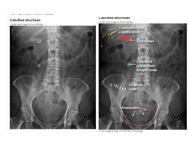 soft tissue radiography | PPTX