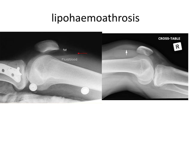 soft tissue radiography | PPTX