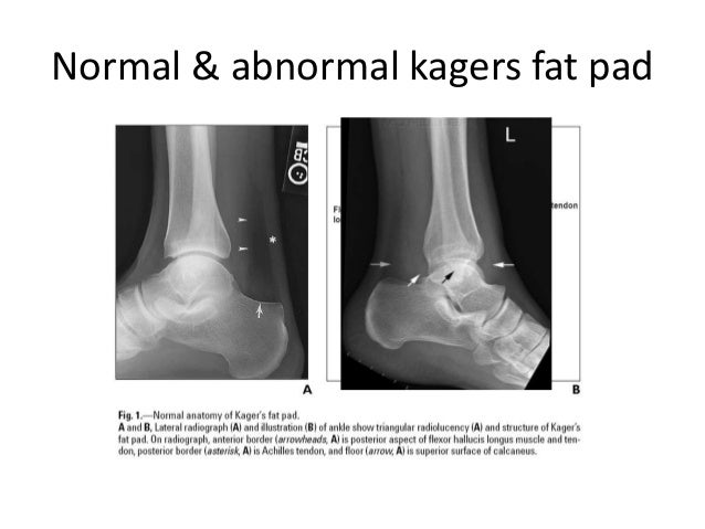 soft tissue radiography