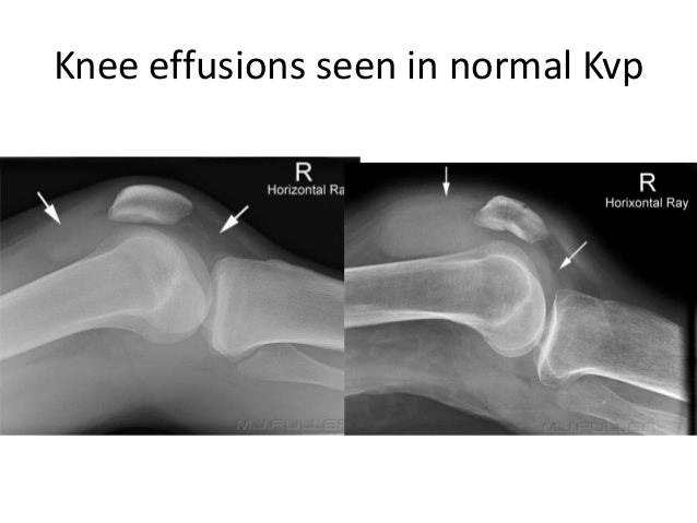 soft tissue radiography