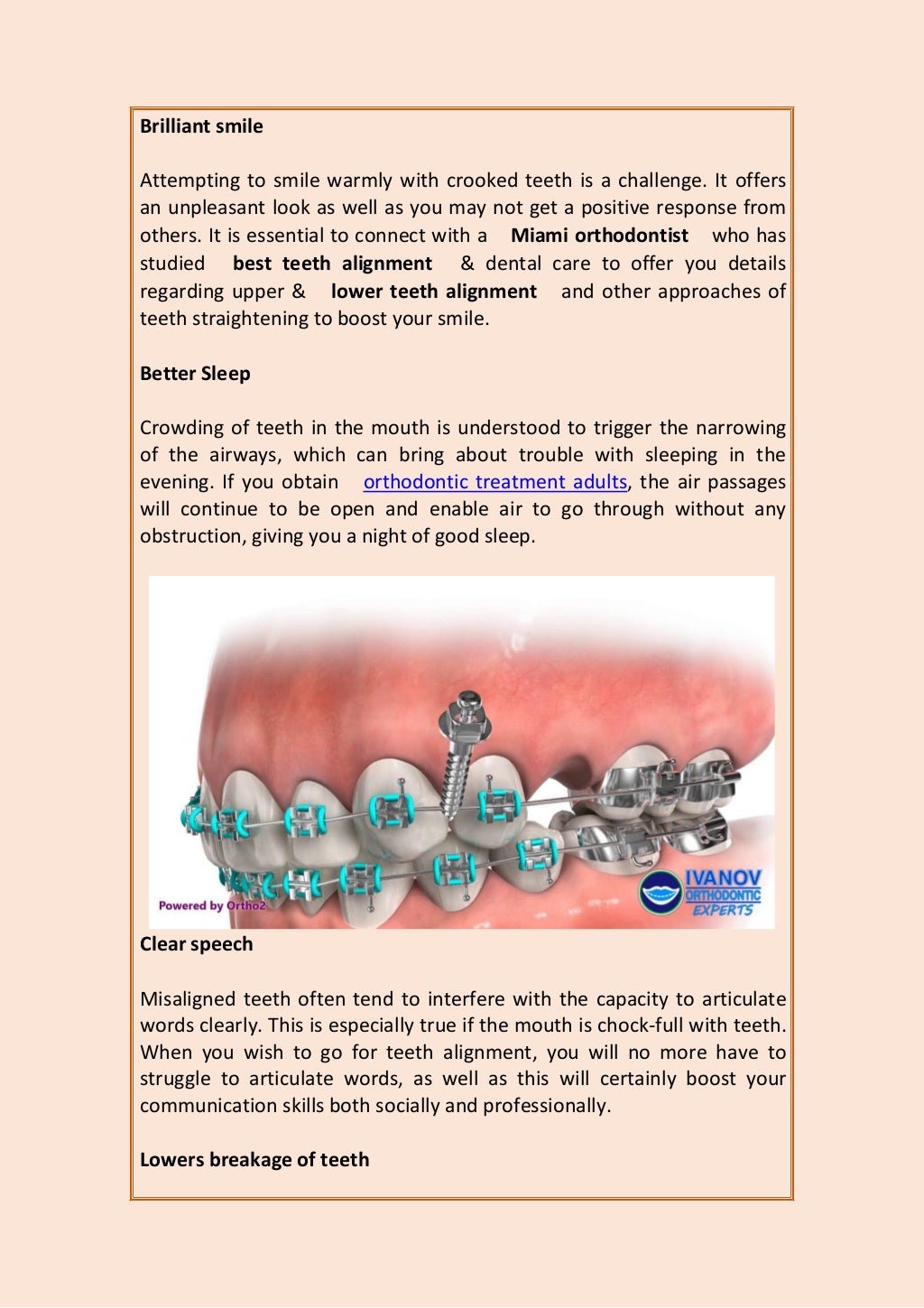 What Are The Benefits Of Having A Teeth Alignment Procedure