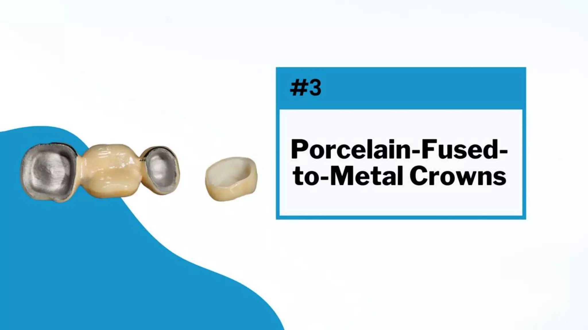 What are the Different Types of Dental Crowns.pptx