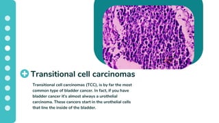 What Are The Different Types of Prostate Cancer | PDF