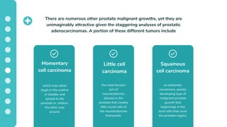 What Are The Different Types of Prostate Cancer | PPT
