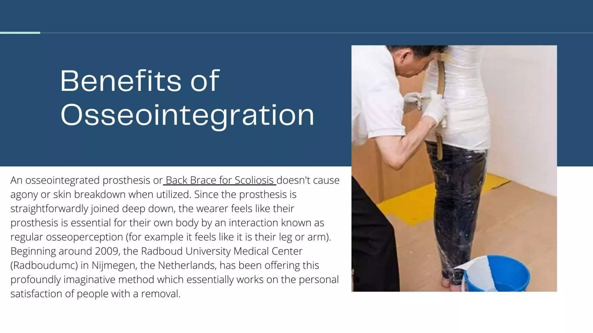 What are the primary advantages of Prosthetics and Compression socks.pptx