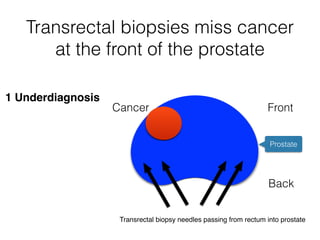 What are the problems with transrectal biopsies of the prostate for ...