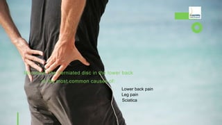 What are the Risk Factors Associated with Herniated Disc in Lower Back ...