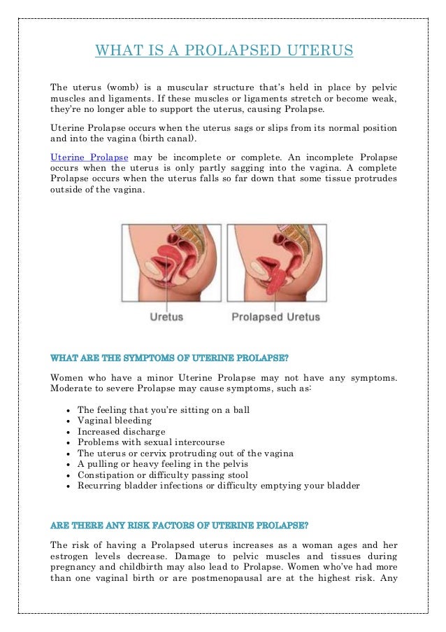 What are the symptoms of uterine prolapse?