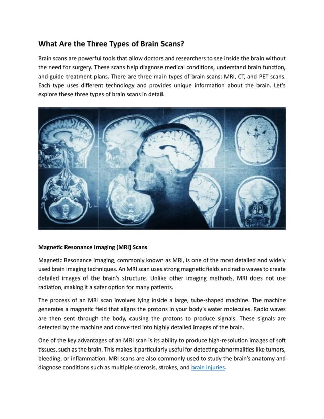 What are the three types of brain scans.pdf