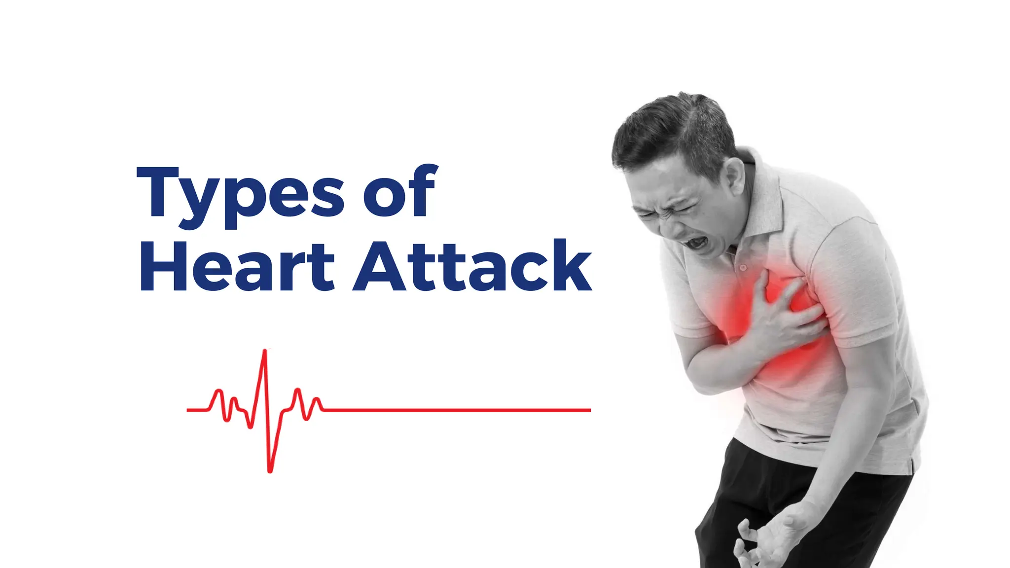 What are the Types of Heart Attack. pptx | PPTX