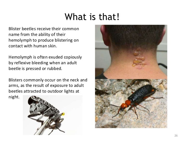 Blister Beetles Bites