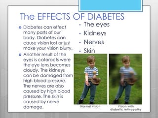 What causes diabetes | PPT
