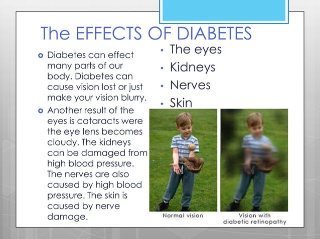 What causes diabetes | PPT