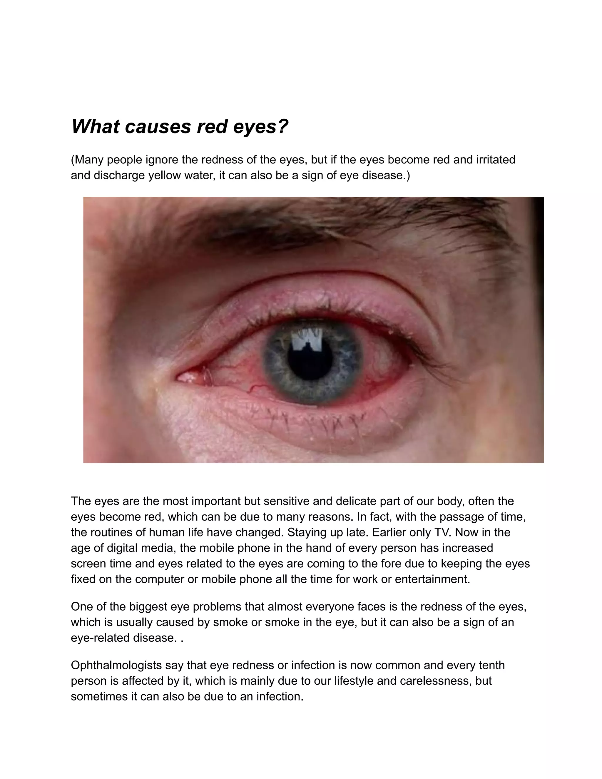 What causes red eyes.pdf