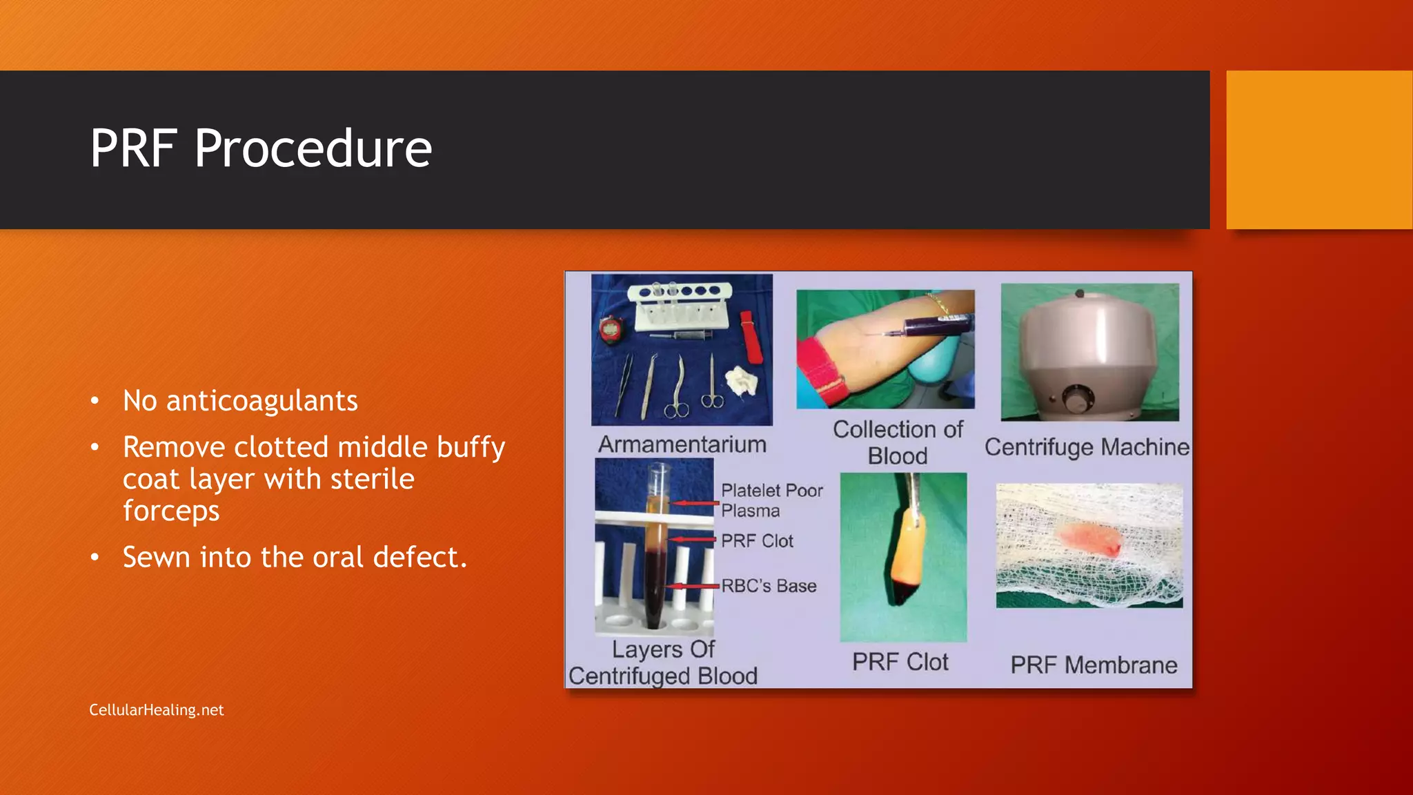 What do we do with platelet poor plasma | PPTX