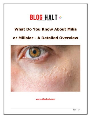 What Do You Know About Milia or Milium - A Detailed Overview.pdf
