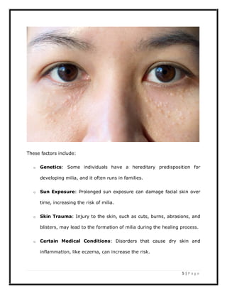 What Do You Know About Milia or Milium - A Detailed Overview.pdf