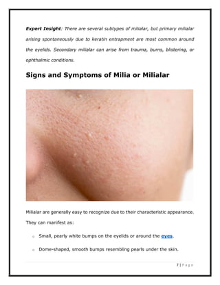 What Do You Know About Milia or Milium - A Detailed Overview.pdf