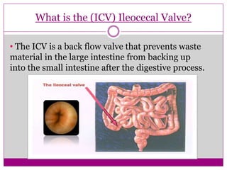 What Exactly Is Arthritis And How Do We | PPTX