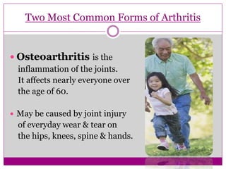 What Exactly Is Arthritis And How Do We | PPTX