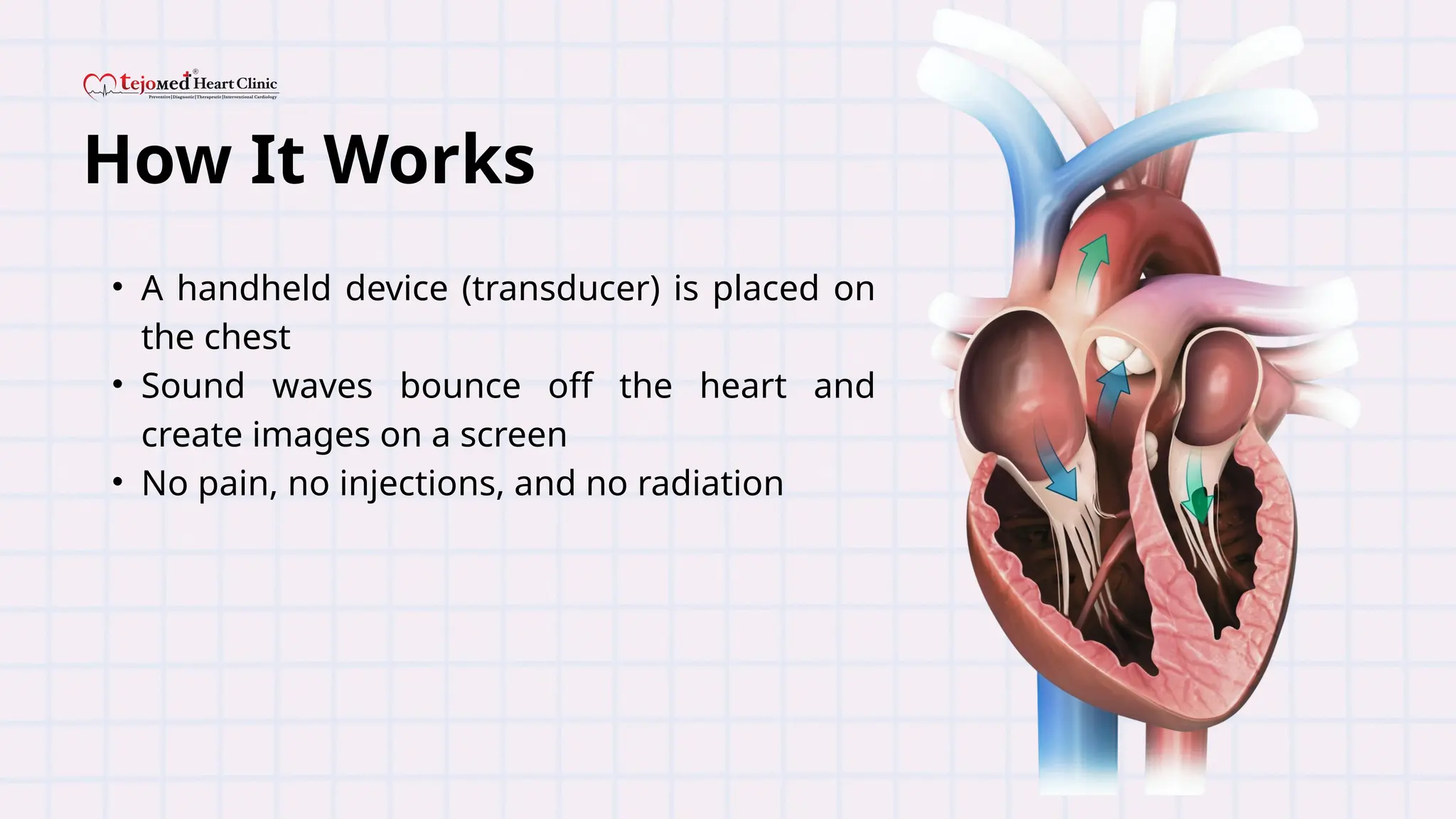 2D Echo Test Explained: Purpose, Procedure & Benefits | PPTX