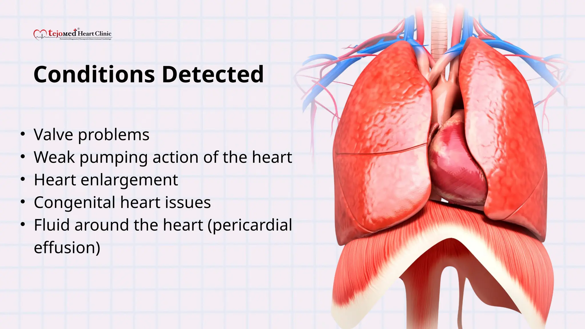 2D Echo Test Explained: Purpose, Procedure & Benefits | PPTX