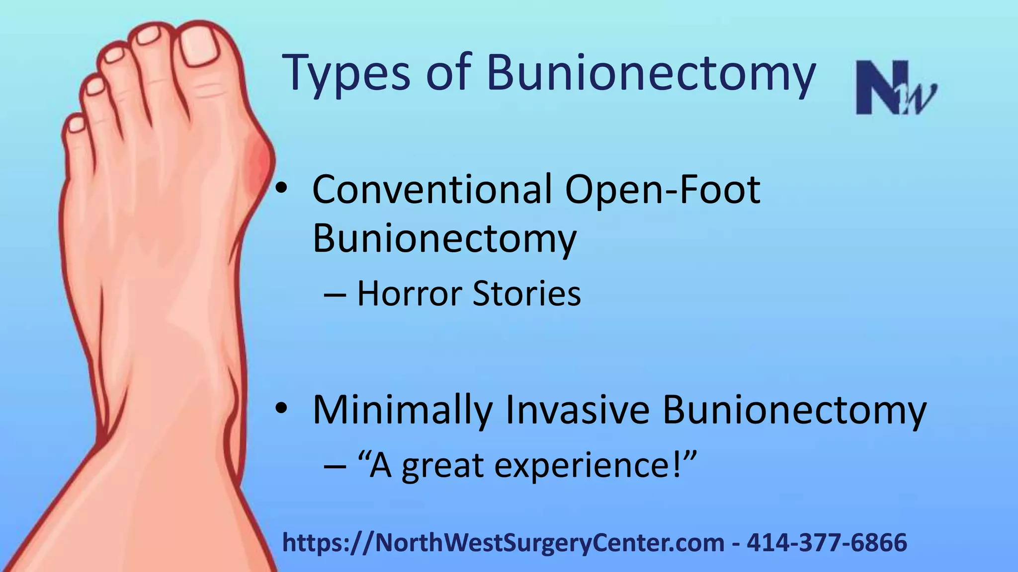 What Is A Bunionectomy? | PPTX