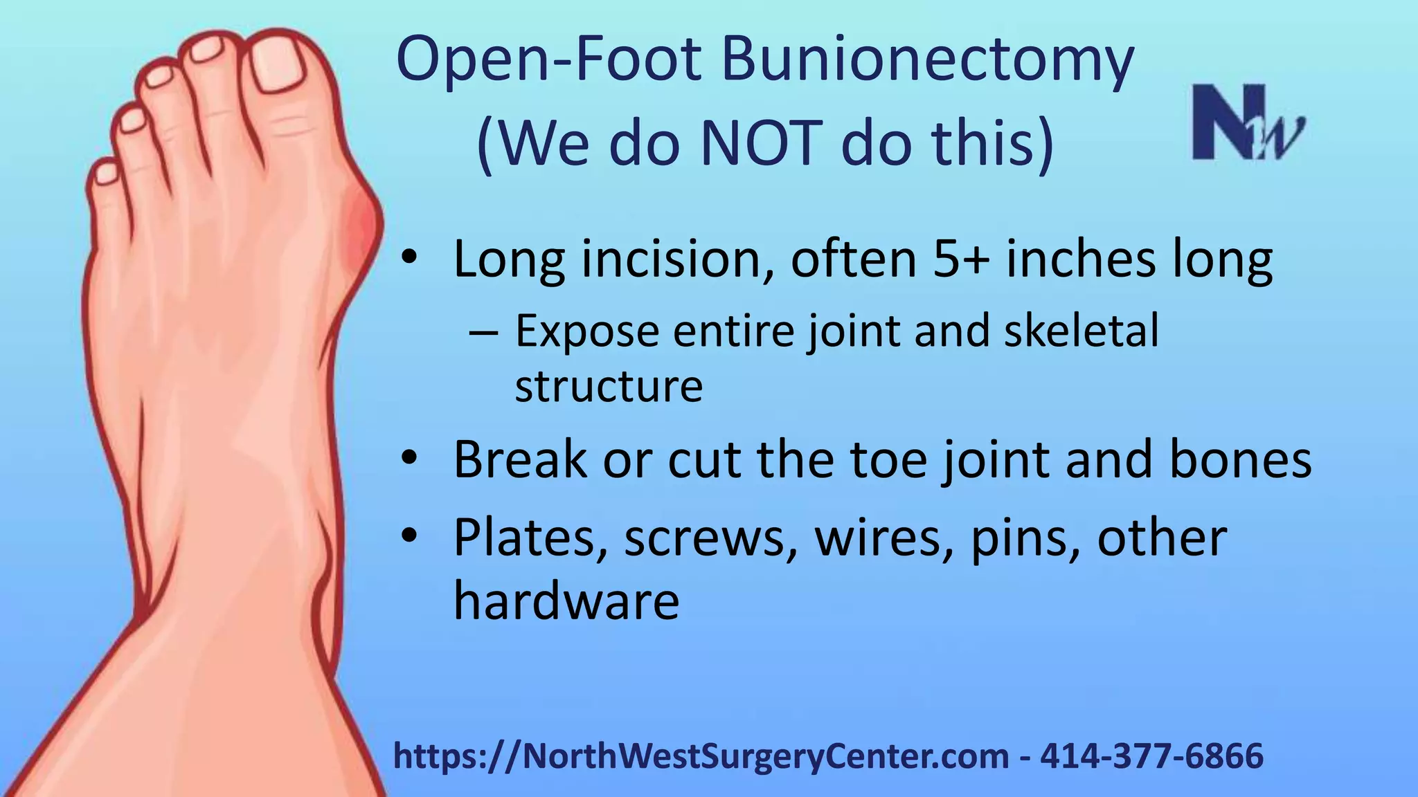 What Is A Bunionectomy? | PPTX