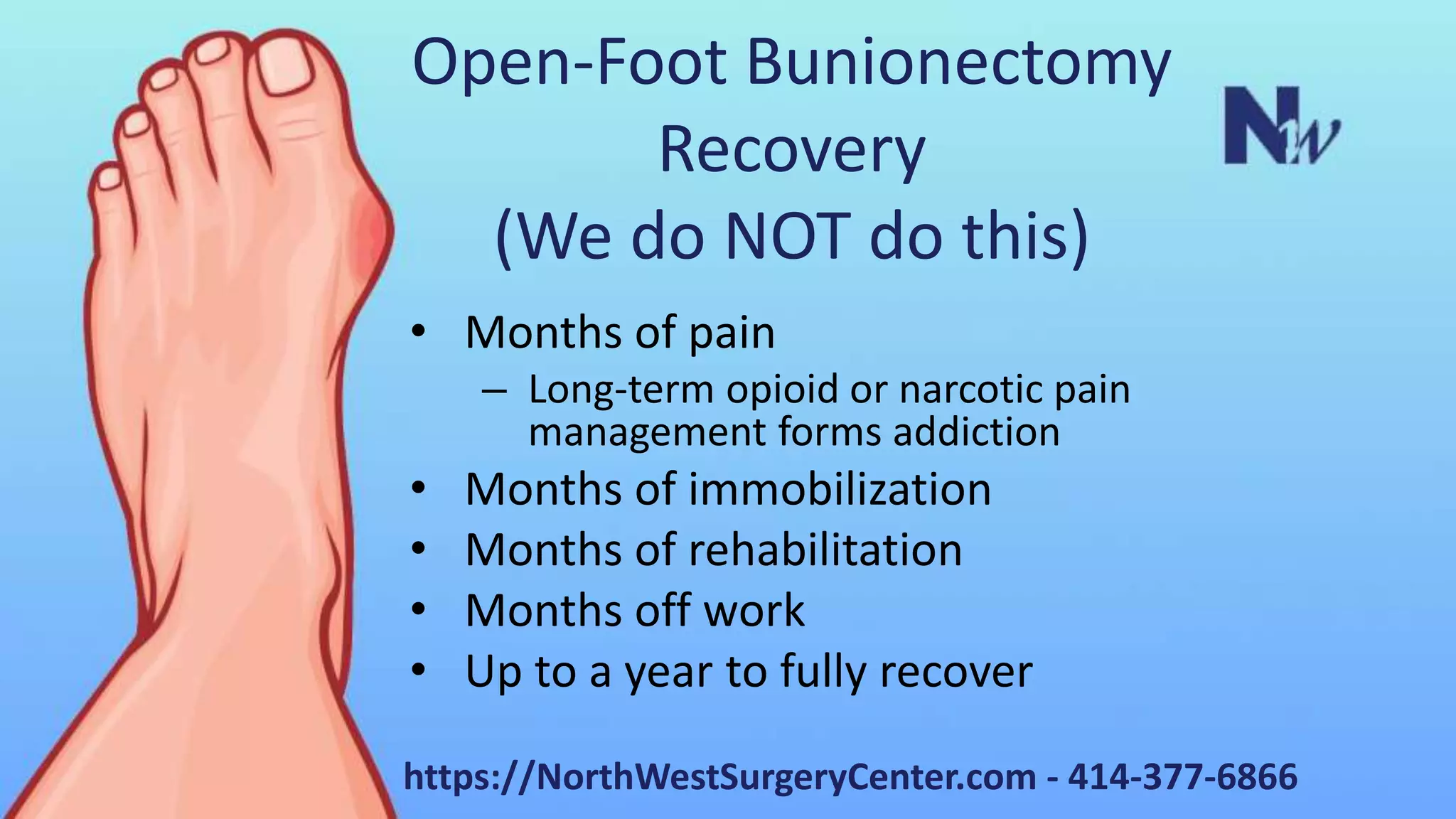 What Is A Bunionectomy? | PPTX