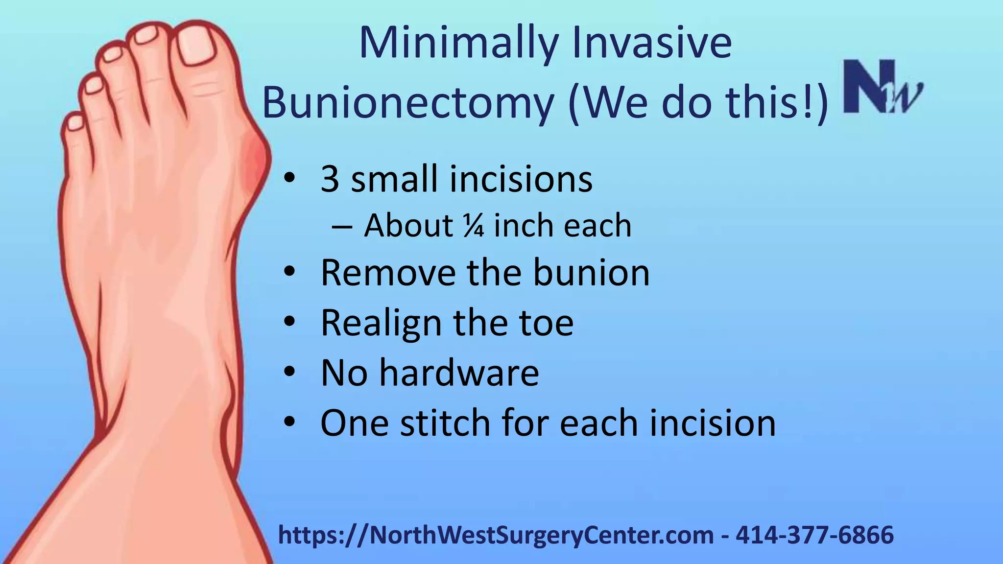 What Is A Bunionectomy? | PPTX