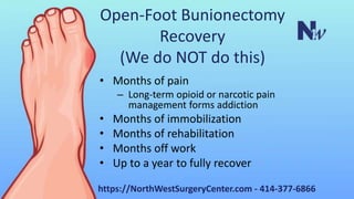 What Is A Bunionectomy? | PPTX