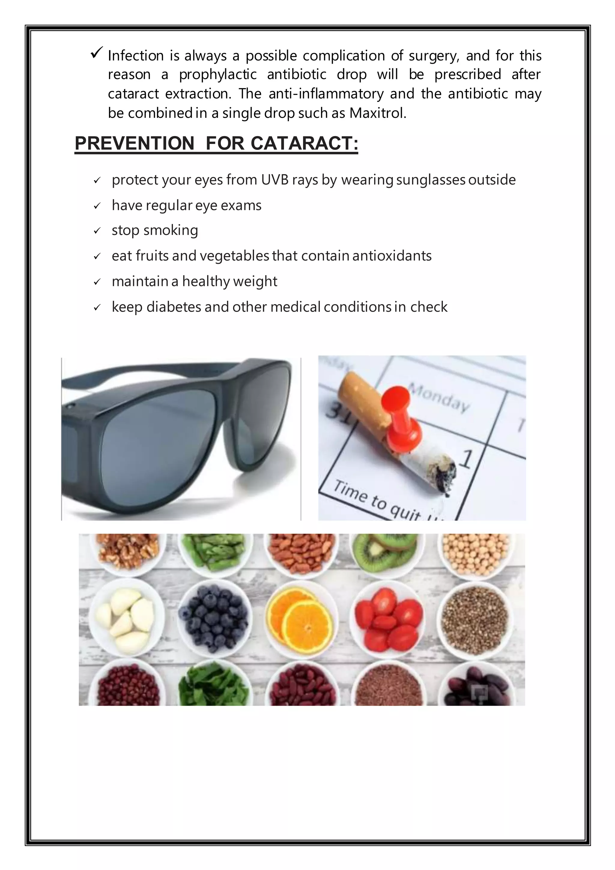 Cataract | DOCX