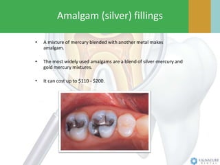 What is a Dental Filling by Signature Dental | PPT