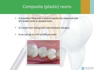 What is a Dental Filling by Signature Dental | PPT