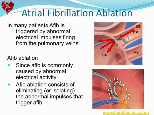 What is Atrial Fibrillation (afib)? | PPTX