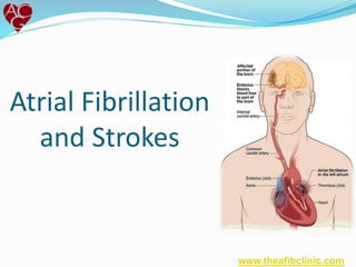 What is Atrial Fibrillation (afib)? | PPTX