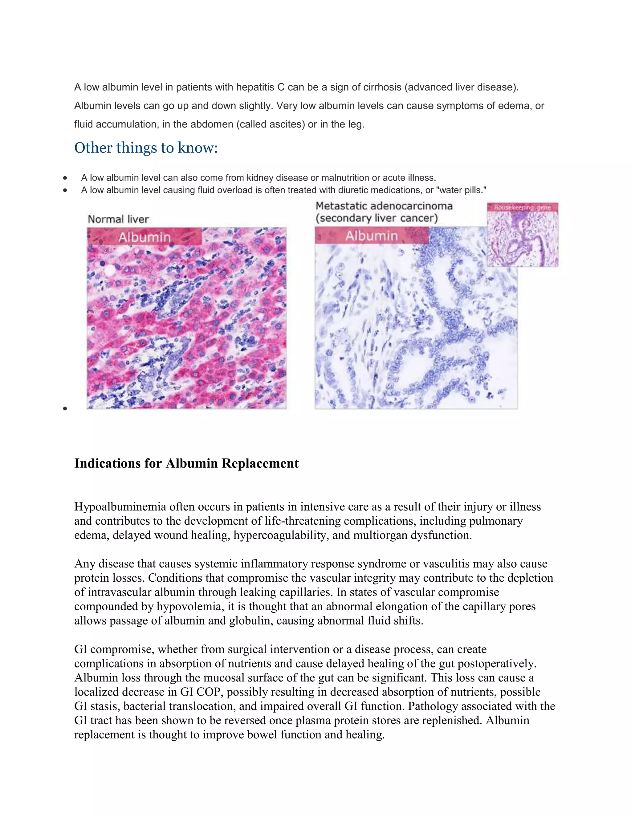 What is Albumin.docx