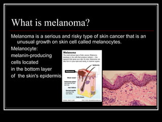 What is a melanoma | PPT