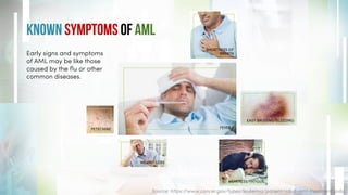 Acute Myeloid Leukemia (AML): Cancer of the Blood & Bone Marrow | PDF ...