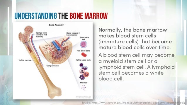 Acute Myeloid Leukemia (AML): Cancer of the Blood & Bone Marrow